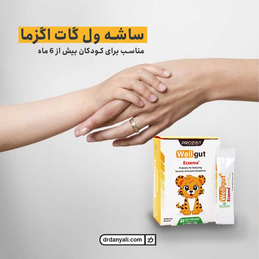 ساشه ول گات اگزما زیست تخمیر 30 عدد | داروخانه آنلاین دکتر دانیالی ...